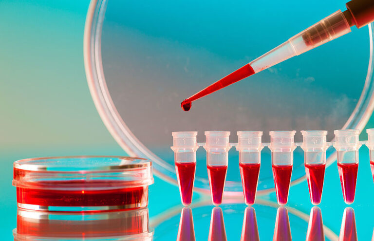 Learn the Advantages of HIV Testing in Singapore – Miosuperhealth