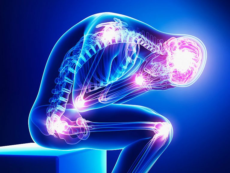 Top 6 Natural Ways To Alleviate Your Chronic Pain – Miosuperhealth